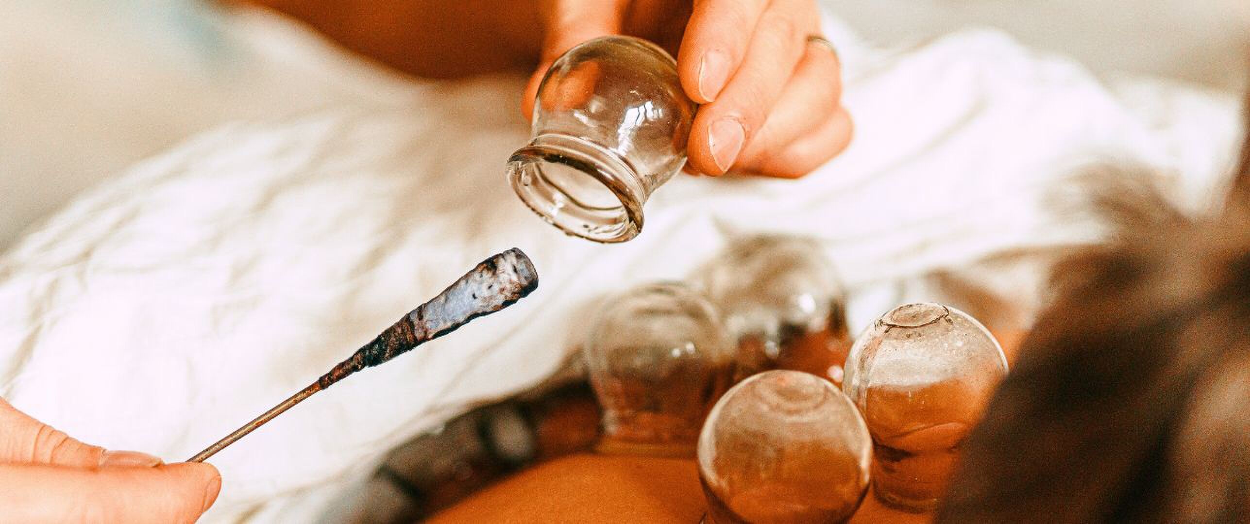 Wet cupping, wat is het en is het gevaarlijk?