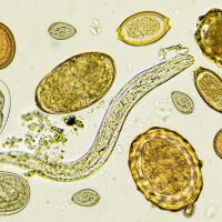 Parasieten bij mensen: de gastheer die je langzaam ziek maakt