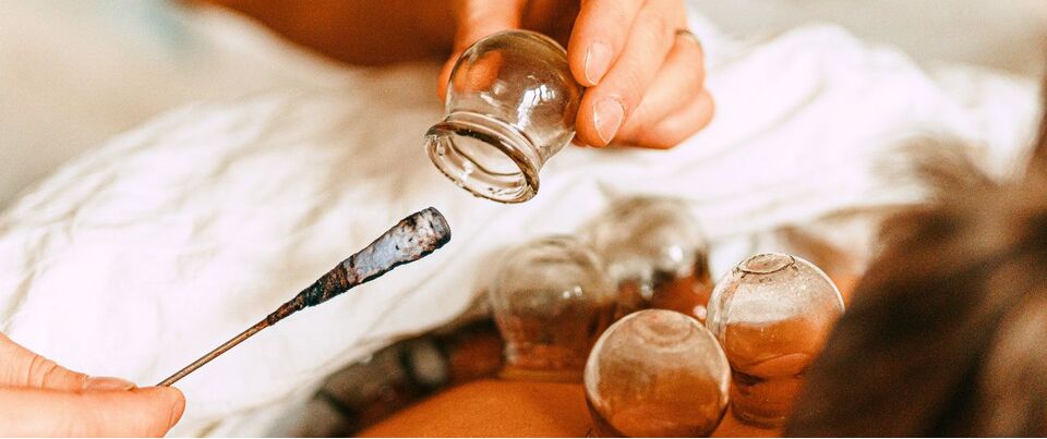 Wet cupping, wat is het en is het gevaarlijk?